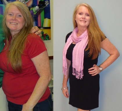 Weight Loss Testimonials and Reviews | Before & After Photos