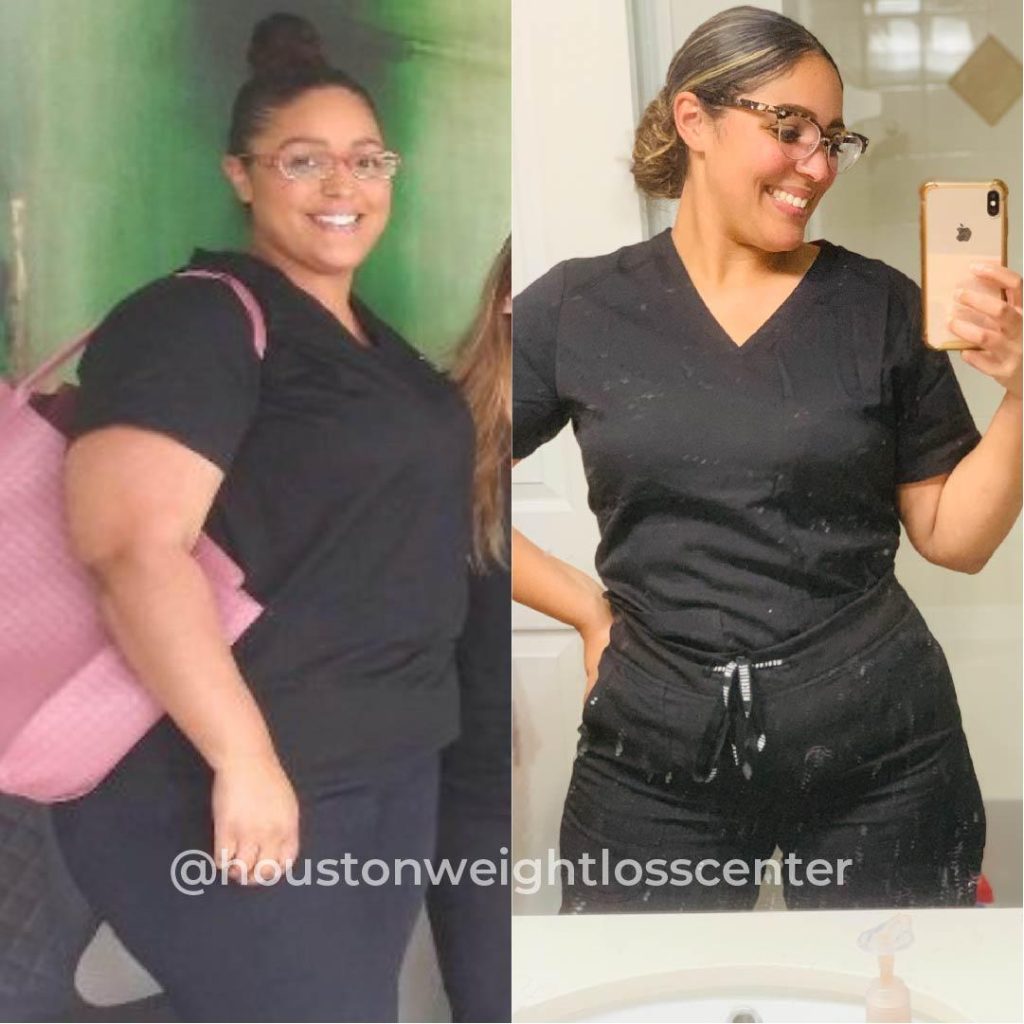 Weight Loss Testimonials and Reviews | Before & After Photos